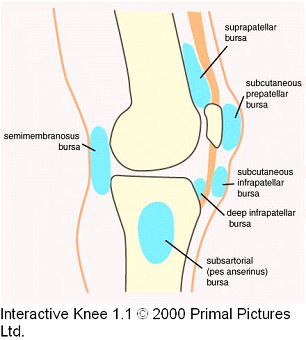 Knee Bursitis